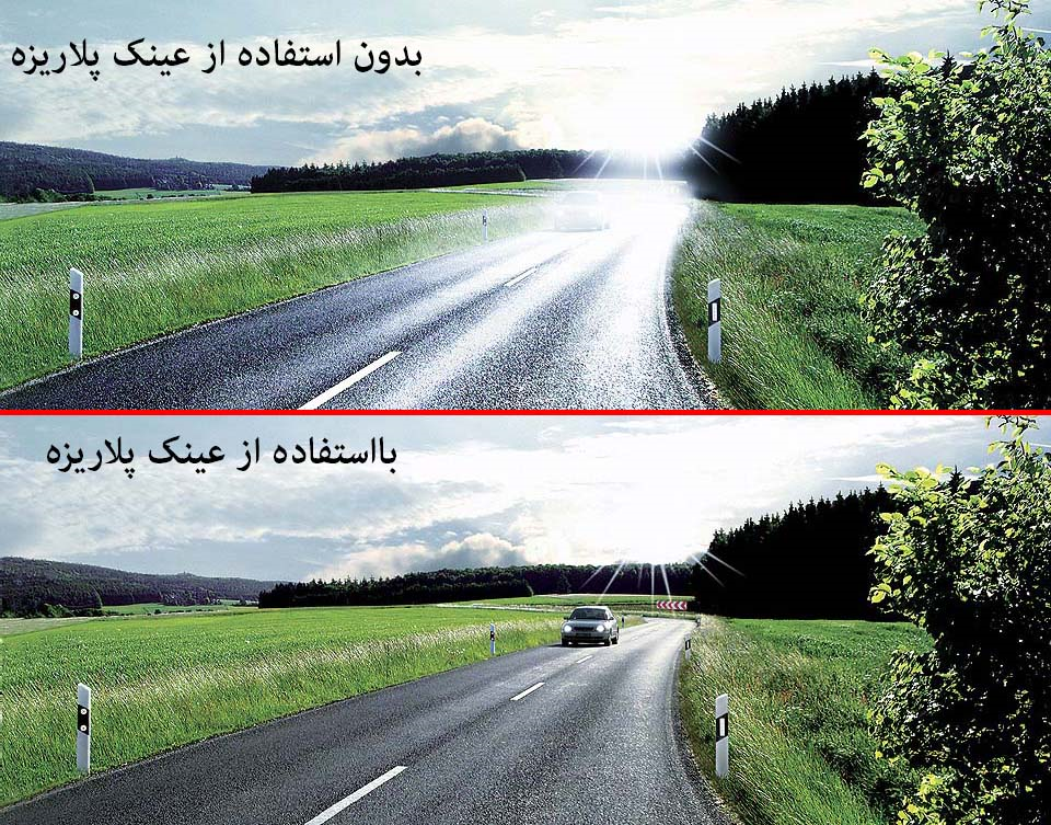 همه چیز درباره عینک مخصوص عمل لیزیک - گالری عینک نظری